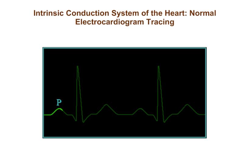 Cardiac Conduction System And Its Relationship With Ecg