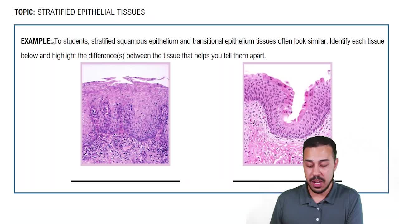 Stratified Epithelial Tissue Labeling Exercise