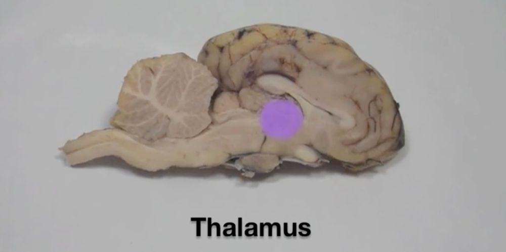 Hypothalamus And Thalamus Sheep Brain