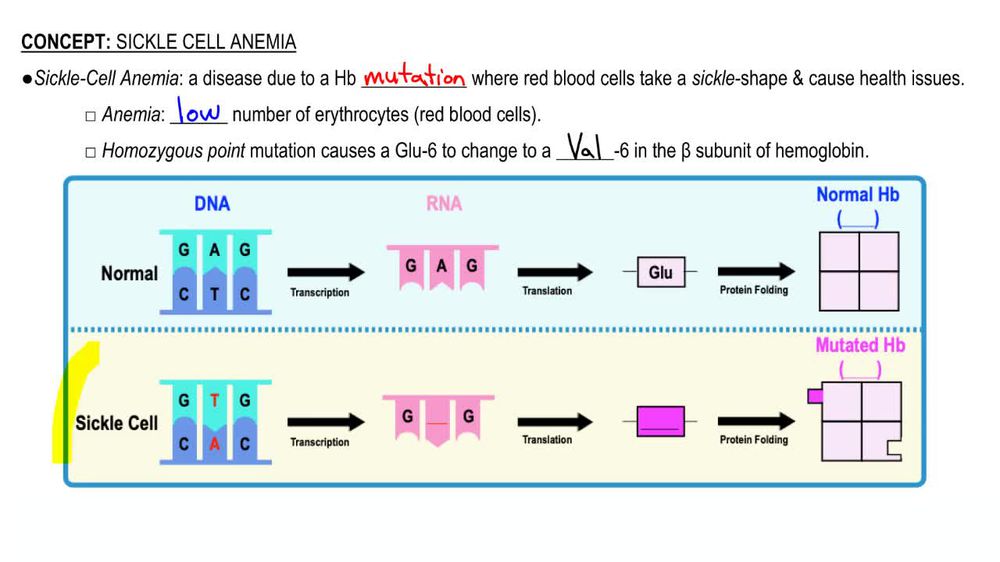 Sickle Cell Anemia Mutation