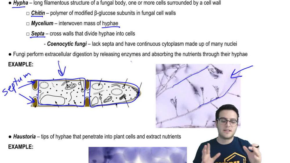 Structure Of Fungal Cell With Diagram Fungi Kingdom Monera Protoctista